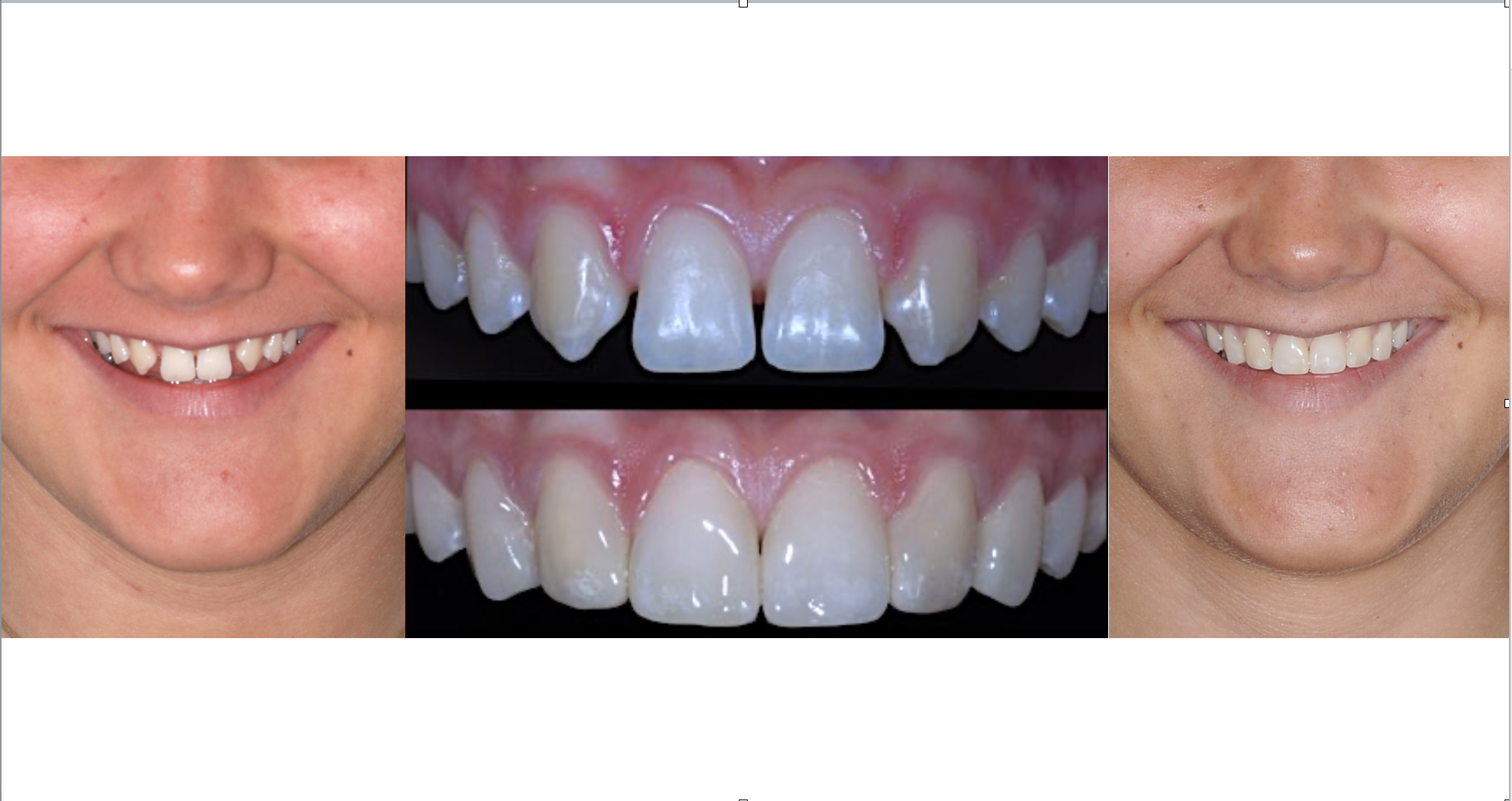 Tooth aesthetics - Dott. Marco Rosa